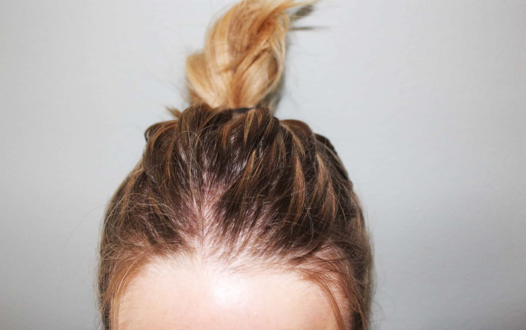 En løsning på dit hårtab - HairBoost.dk